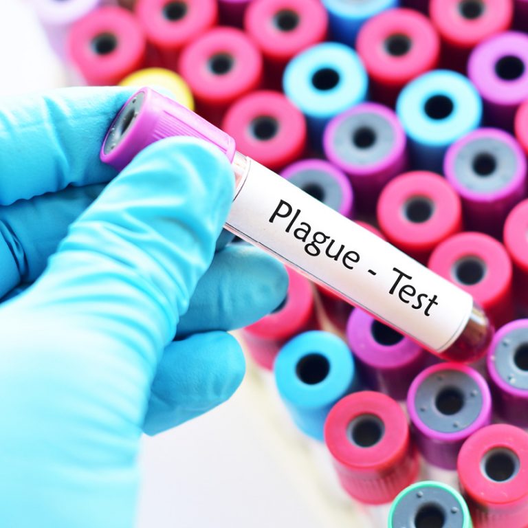 Single Use Dental Instruments | Diagnostic Dental Instruments ...